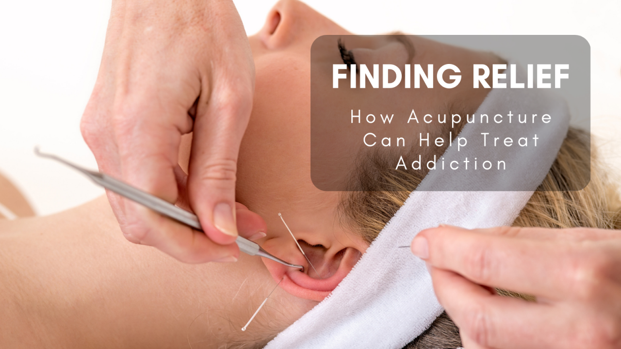 Finding Relief: How Acupuncture Can Help Treat Addiction | Kokin ...