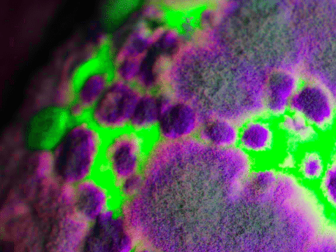 Bud Rot on Cannabis Plants: Causes, Symptoms and Treatments